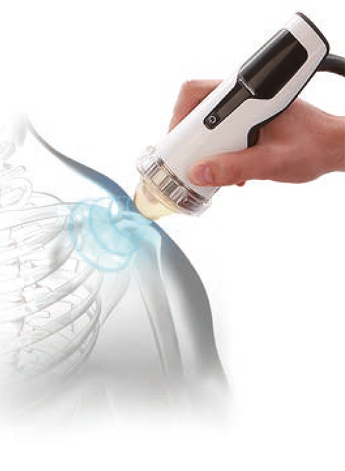 Shockwave Therapy in Cape Coral - Hancock Healthcare Group